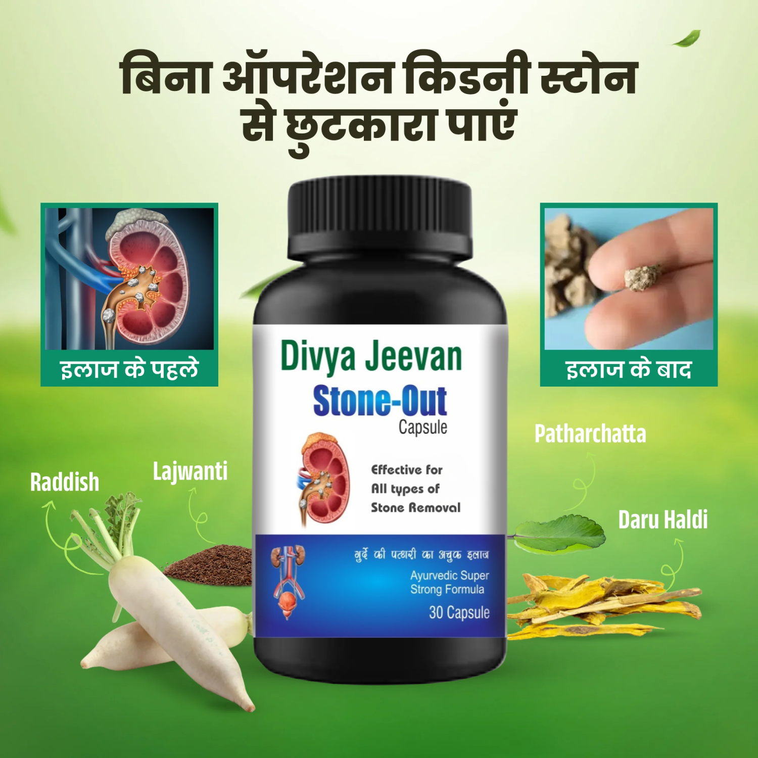 Ayurvedic Treatment of Pathri (Kidney Stone) and Piles – 100% safe ...